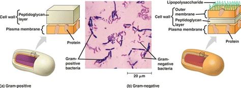 Quia 9ap Chapter 27 Bacteria And Archaea Detailed Plasma Membrane Organic Molecules