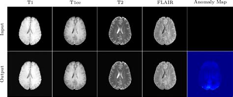 Figure 2 From Diffusion Models For Medical Anomaly Detection Semantic