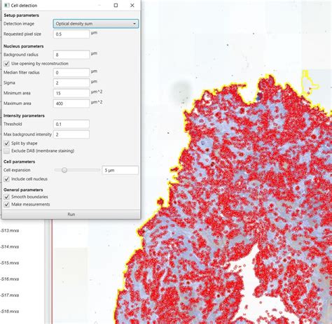 Qupath Project Running Detecting Tissue Classifying Cells Image