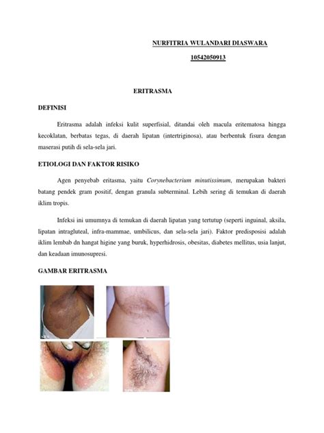 Tugas Eritrasma Trikomonas Vaginalis Dan Siklus Hidup Scabies Pdf