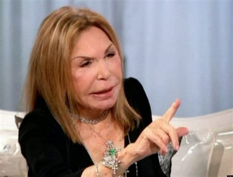 Elsa Pattonthe Worst Example Of Plastic Surgery Disaster 28 Pics