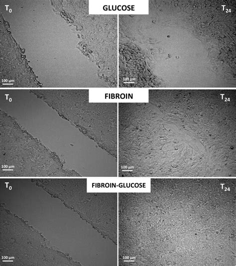 Evaluation Of Cell Migration Through In Vitro Scratch Assay In Presence