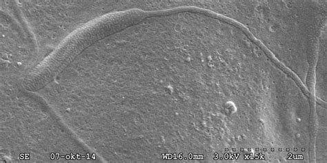 Sperm Cell Under Electron Microscope