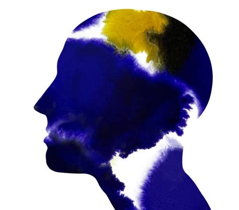 Ritlecitinib Clarivate