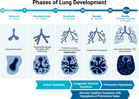 Pediatric Diffuse Lung Disease In Infants Imaging Findings And