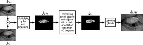 the main steps of the gland segmentation algorithm consisting of download scientific diagram