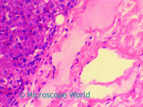Microscope World Blog Gallbladder Under The Microscope