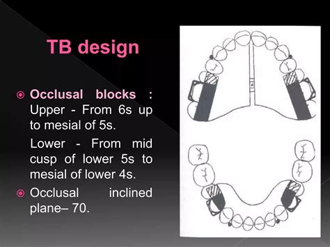 Modification Of Twin Block Functional Appliance Ppt