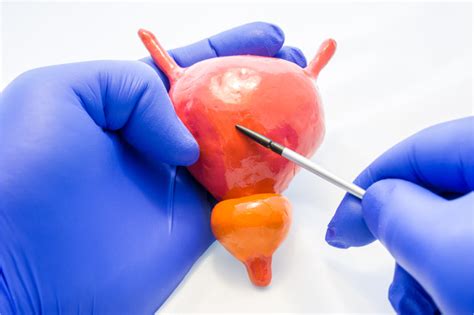 Useful Tips For Bladder Surgery Recovery