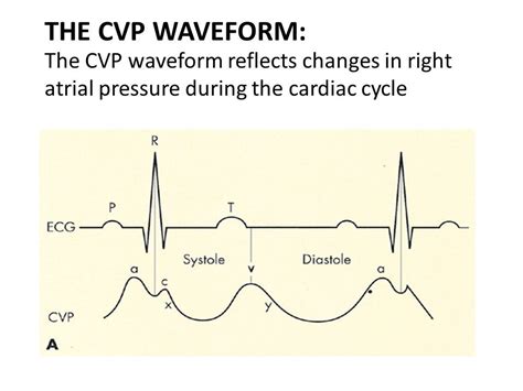 Image Result For Cvp Waveform Cardiac Cycle Cardiovascular System Med School