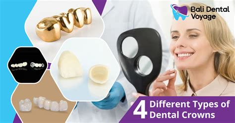 4 Types Of Crowns Dental Types Of Dental Crowns