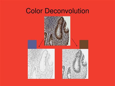 PPT Can Color Detect Cancer PowerPoint Presentation Free Download ID 375605