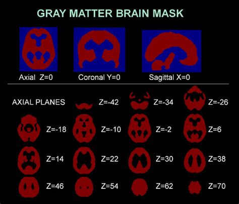 Identification Of Disease Related Spatial Covariance Patterns Using Neuroimaging Data