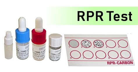 Rapid Plasma Reagin Rpr Test