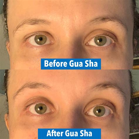 How To Do Facial Gua Sha For Lymphatic Drainage And Anti Aging Benefits