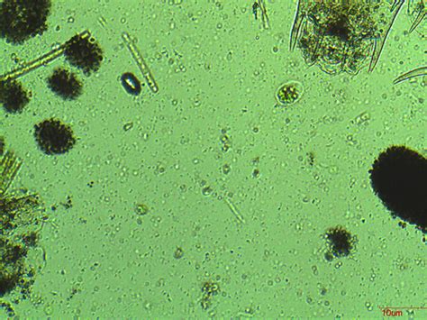 Transfer Learning Stage 1 From Green Dataset Object Detection Dataset