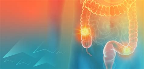 Nccn Expands Genetic Risk Assessment Guidelines To Include Additional