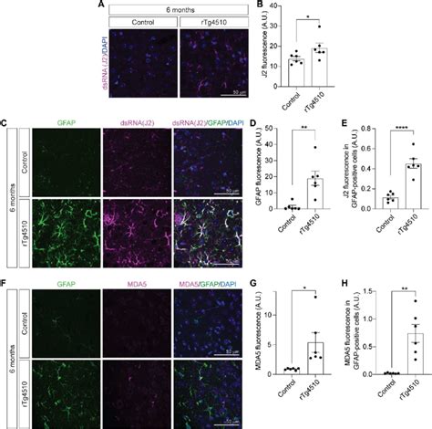 Dsrna And Dsrna Sensing Machinery Are Elevated In Astrocytes Of The