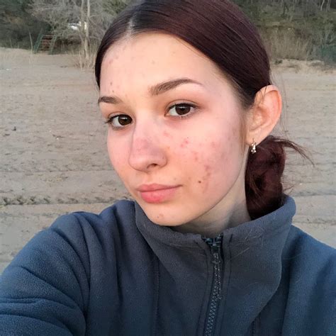 Пин от пользователя Lolita 🍒 на доске Skin And Body Positivity Чистая