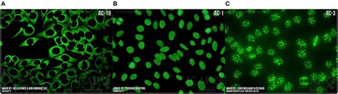 Indirect Immunofluorescence Demonstrating “anti Nuclear” Antibody Bound Download Scientific
