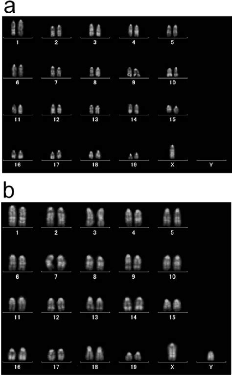 Figure 2 From Sex Reversed Somatic Cell Cloning In The Mouse Semantic Scholar
