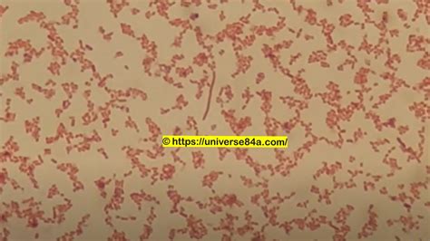 Enterobacter Gram Stain Results