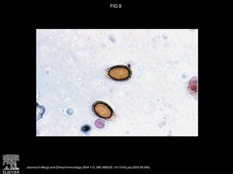 An Atlas Of Fungal Spores Ppt Download