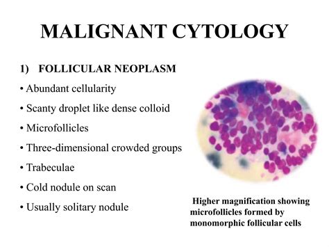 Thyroid Cytology Pptx Pptx
