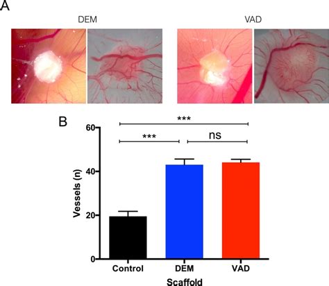 Vacuum Assisted Decellularization An Accelerated Protocol To Generate Tissue Engineered Human