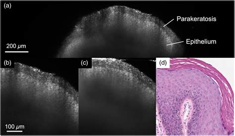 Publications Translational Optical Imaging Lab