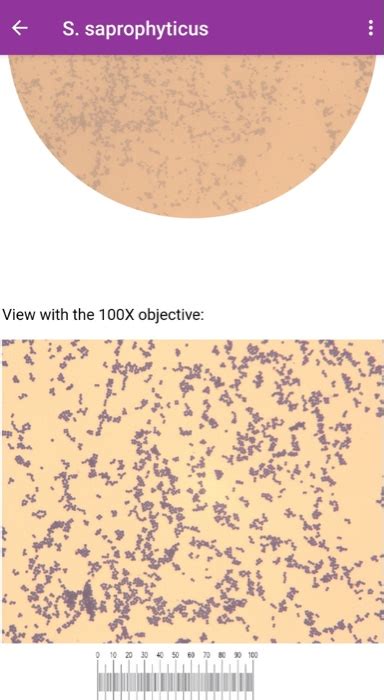 Staphylococcus Saprophyticus Gram Stain