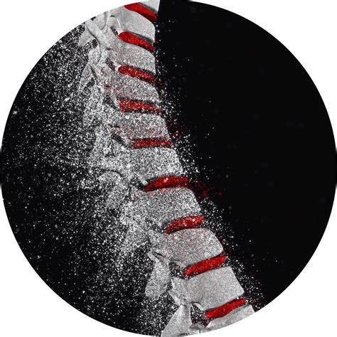 Dexa Scan Bone Mineral Density Scan Aarthi Scans And Labs