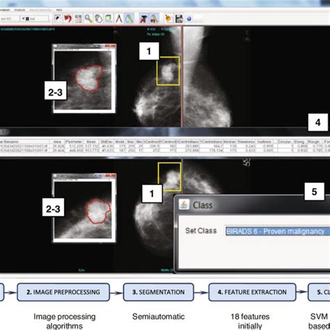 PDF Discovering Mammography Based Machine Learning Classifiers For Breast Cancer Diagnosis