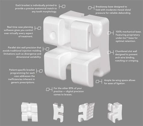 Introducing Lightforce Orthodontics And Its Customized 3d Printed Bracket System