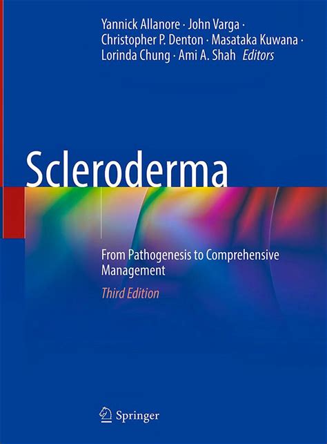 Scleroderma‚ From Pathogenesis To Comprehensive Management