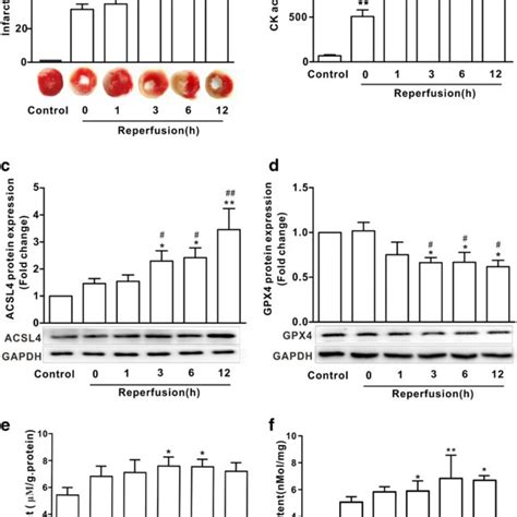 Occurrence Of Ferroptosis In Ischemic Rat Hearts After Reperfusion A Download Scientific
