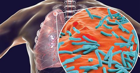 Awas Kuman Tibi Harian Metro