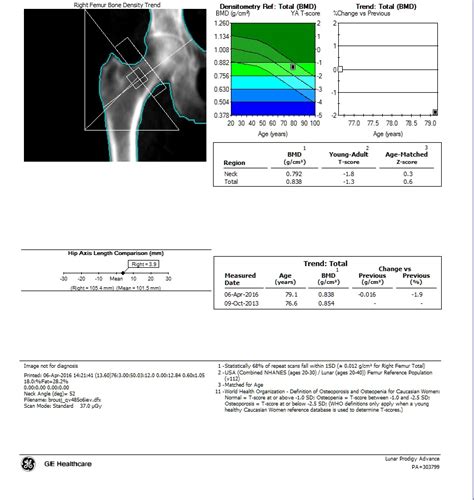 Capstone Object Detection Dataset And Pre Trained Model By Capstone