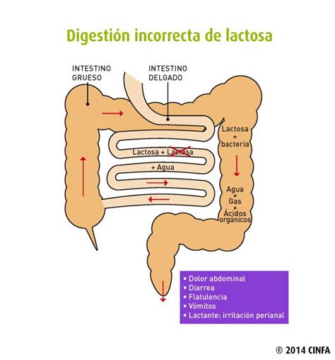 La Intolerancia A La Lactosa Afecta Al 75 De La Población Mundial Salud Y Medicina