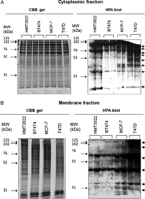 Representative Sds Page Separations And Lectin Blot Of Cytoplasmic Download Scientific