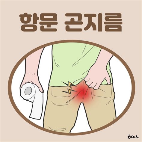 항문 곤지름증상 여자 곤지름 사진 여성 콘딜로마 항문 튀어나옴 간지러움 음부사마귀 네이버 블로그