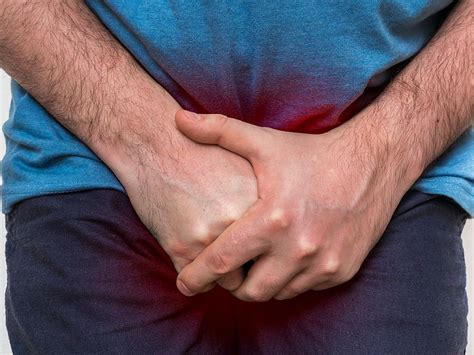 Most Bizarre Sex Injuries Seen In The ER Toronto Sun