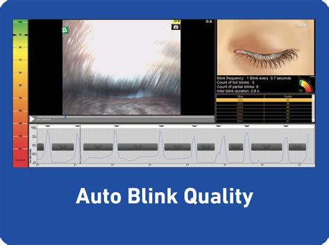 Mands Technologies Bruder Ocular Surface Analyzer Bosa Bruder Healthcare