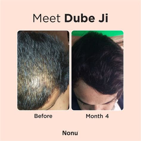 Nonu Care Hair Care Kits Reviews Customer Testimonials And Feedback