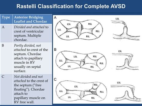 Av Canal Defect Ppt