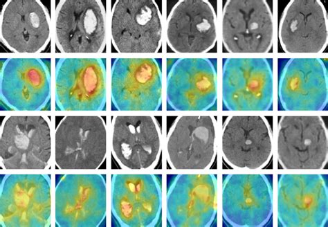 figure 12 from enhanced multi scale features mutual mapping fusion