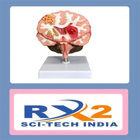 Brain Stroke Model At Best Price In Greater Noida Uttar Pradesh Rx2