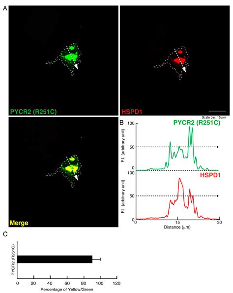 Hypomyelinating Leukodystrophy 10 Hld10 Associated Mutations Of Pycr2