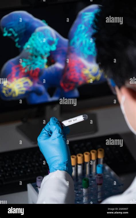 Blood Tests To Detect Sexually Transmitted Diseases Or STDs Hepatitis B And C Syphilis HIV