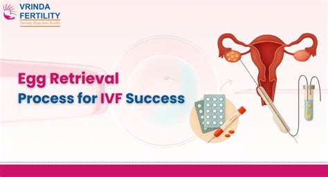 The Egg Retrieval Process (2025)